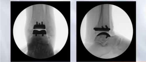 学科精细化促骨科发展迈入新时代_综合_健康一线
